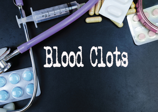 AstraZeneca vaccine: How common are blood clots - KKP Advice Center